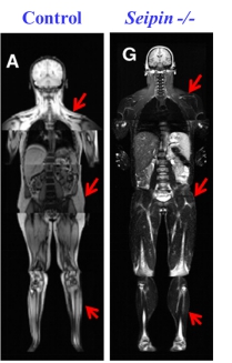 EMBO J: Seipin通过钙依赖性线粒体代谢来调控脂质稳态 -中科脂典
